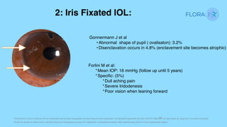IOL options in the absence of capsular support | PDF | Eye and Vision ...