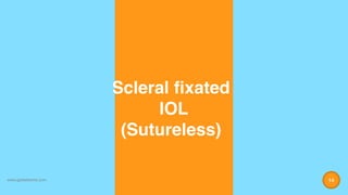 IOL options in the absence of capsular support | PDF | Eye and Vision ...