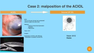IOL options in the absence of capsular support | PDF | Eye and Vision ...