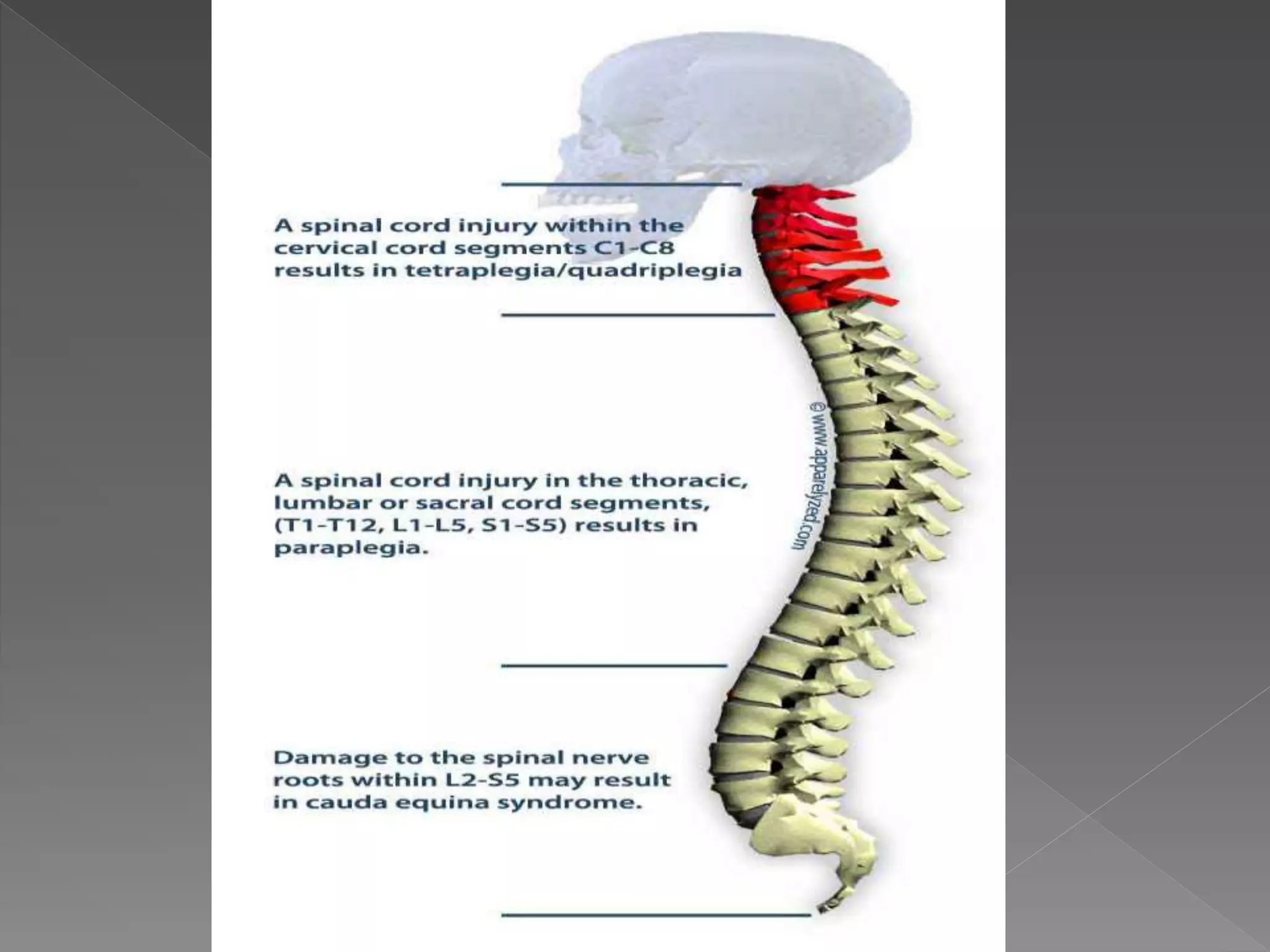 SPINAL CORD INJURY | PPTX | Death, Injury, or Military Conflict ...