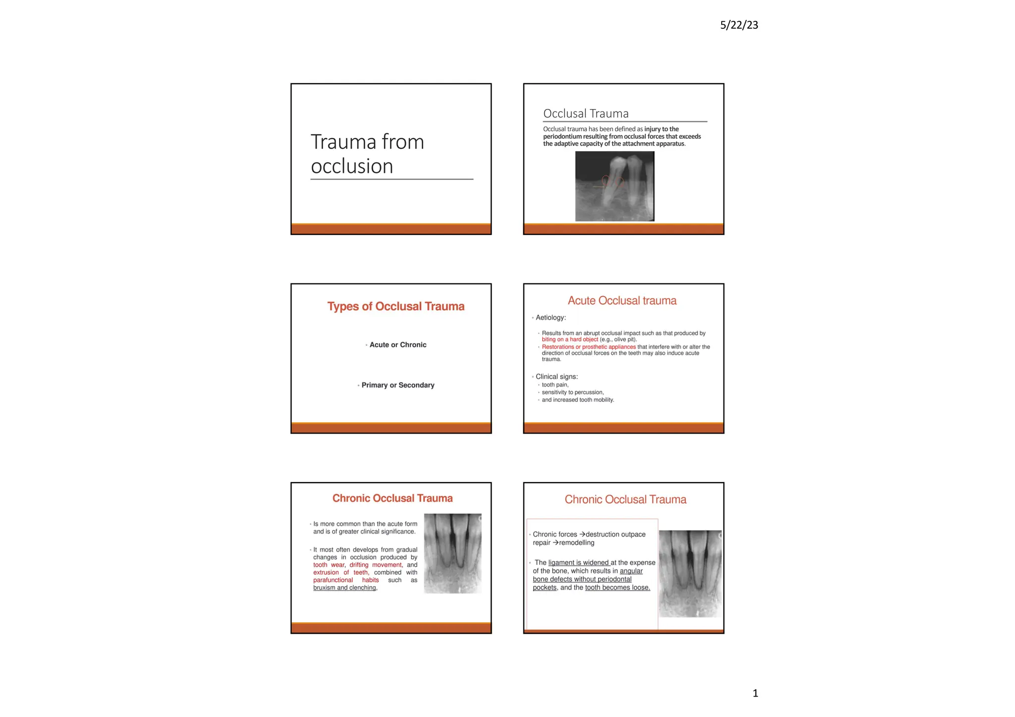 27 Trauma from Occlusion. Perio anatomypdf | PPT