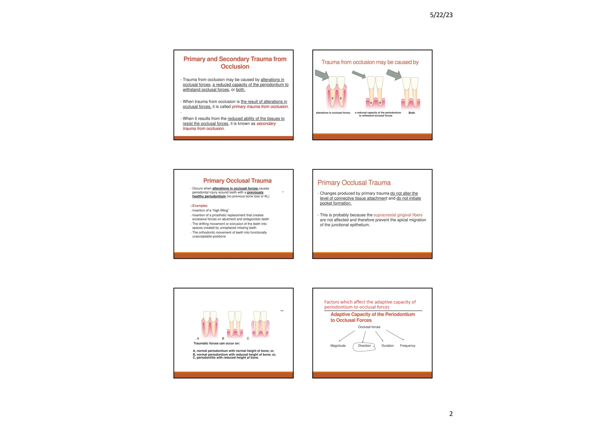 27 Trauma from Occlusion. Perio anatomypdf | PPT