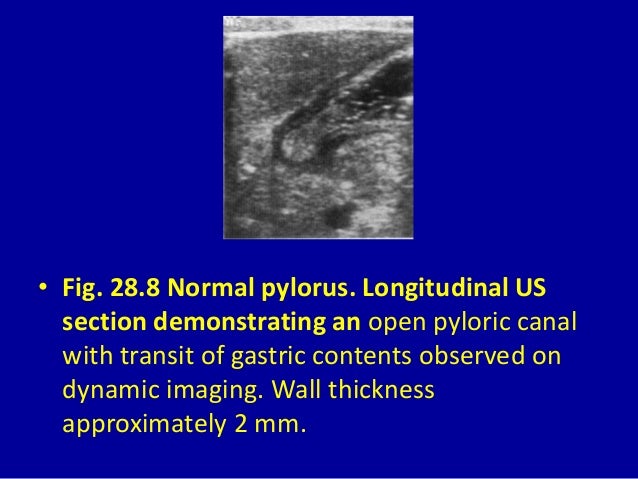 28 DAVID SUTTON PICTURES THE PEDIATRIC ABDOMEN