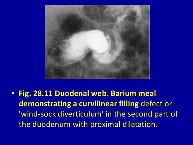 28 DAVID SUTTON PICTURES THE PEDIATRIC ABDOMEN