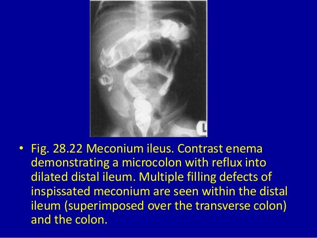 28 DAVID SUTTON PICTURES THE PEDIATRIC ABDOMEN