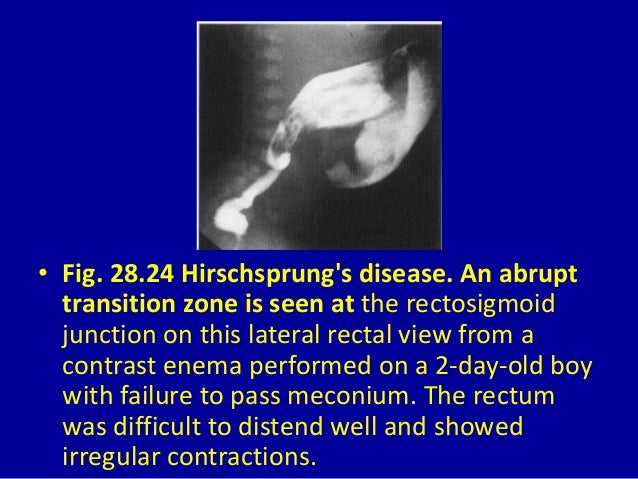 28 DAVID SUTTON PICTURES THE PEDIATRIC ABDOMEN