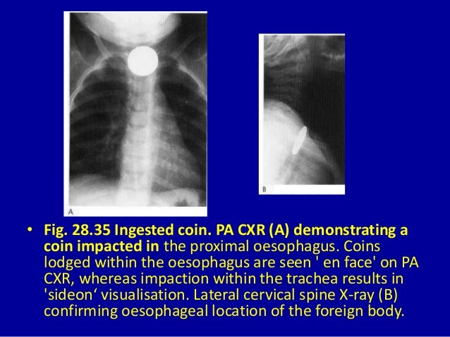 28 DAVID SUTTON PICTURES THE PEDIATRIC ABDOMEN