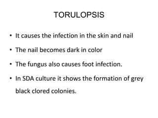 28. oppertunistic mycotic infections | PPT
