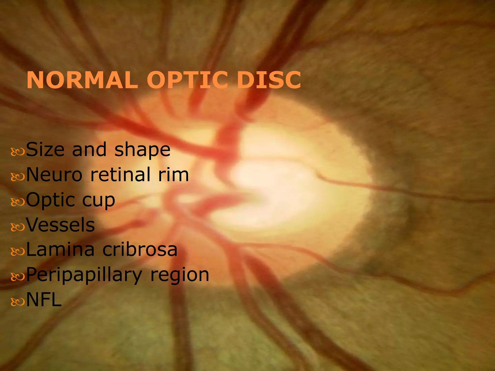 28. ONH evaluation in glaucoma | PPTX