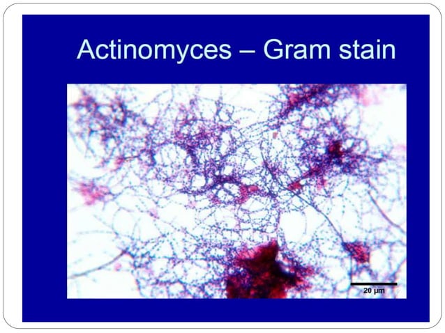 Mycoplasma & actinomycetes | PPT