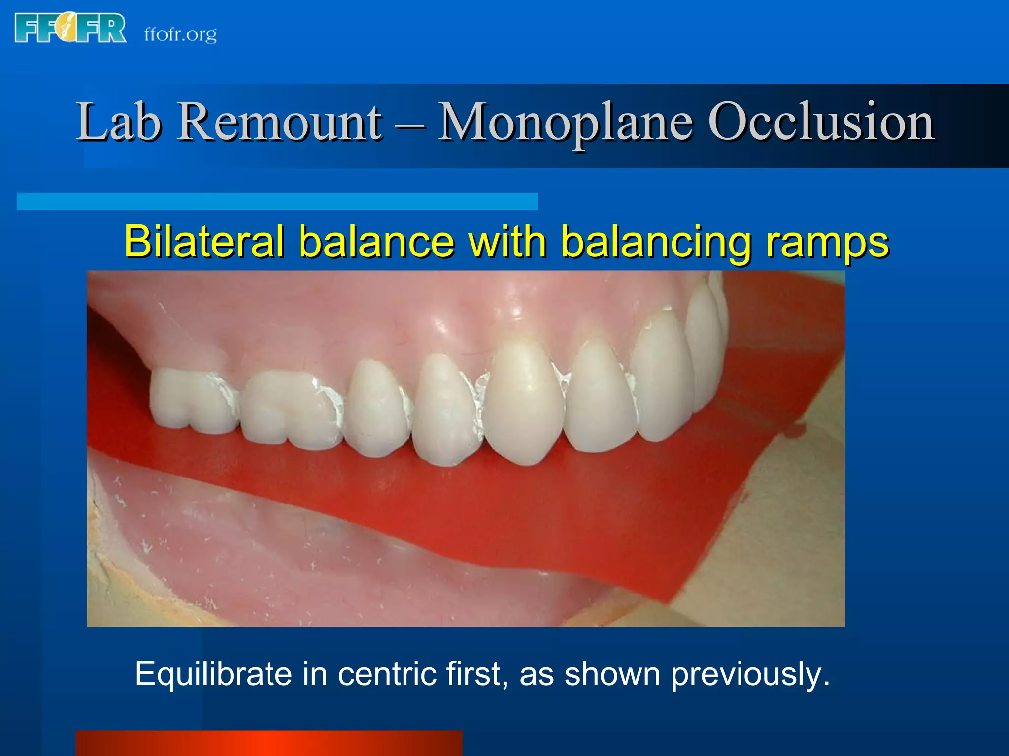 28.laboratory remount | PPT