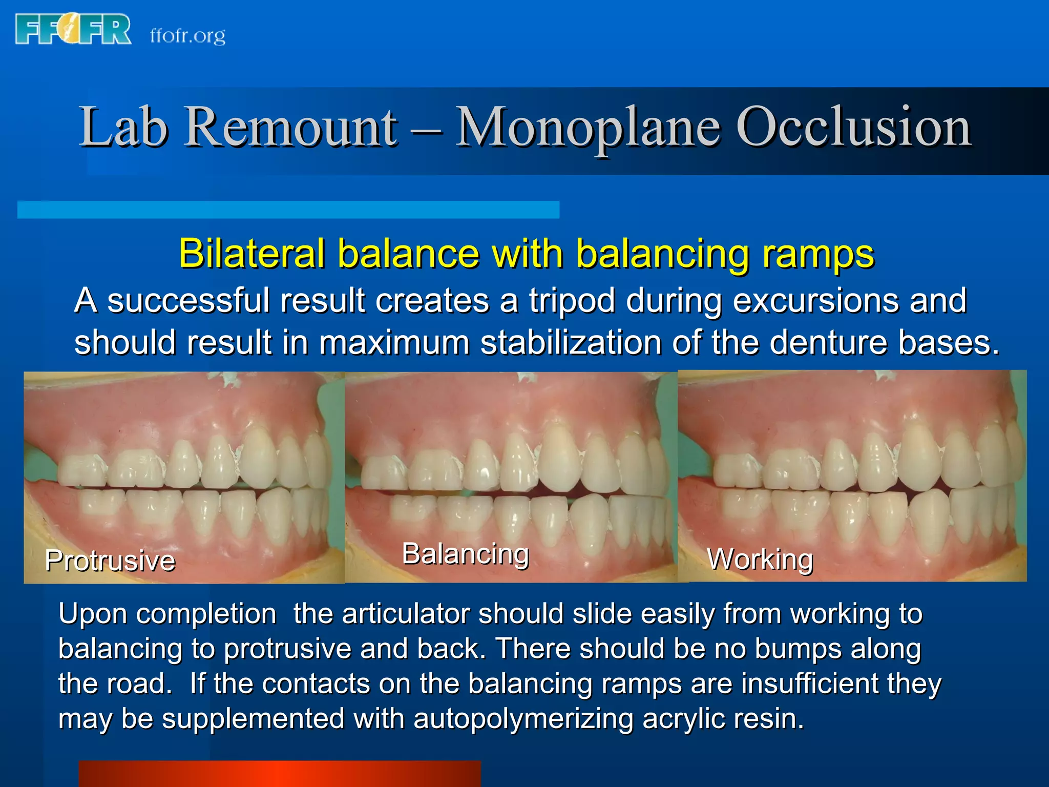 28.laboratory remount | PPT