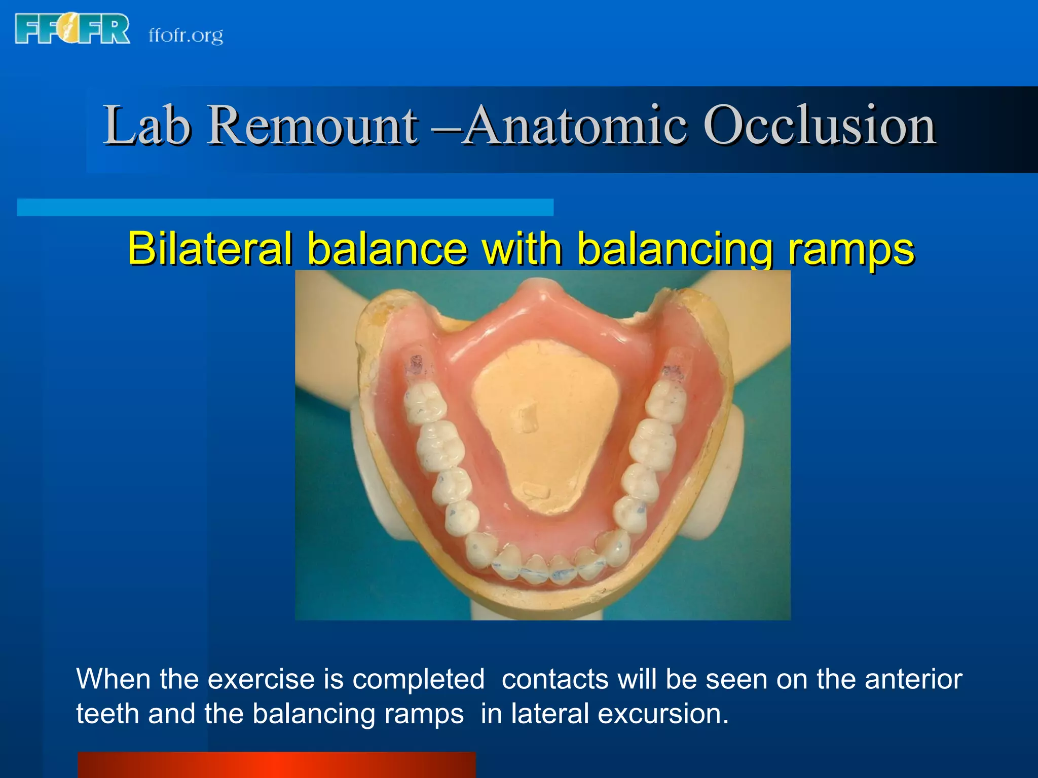 28.laboratory remount | PPT