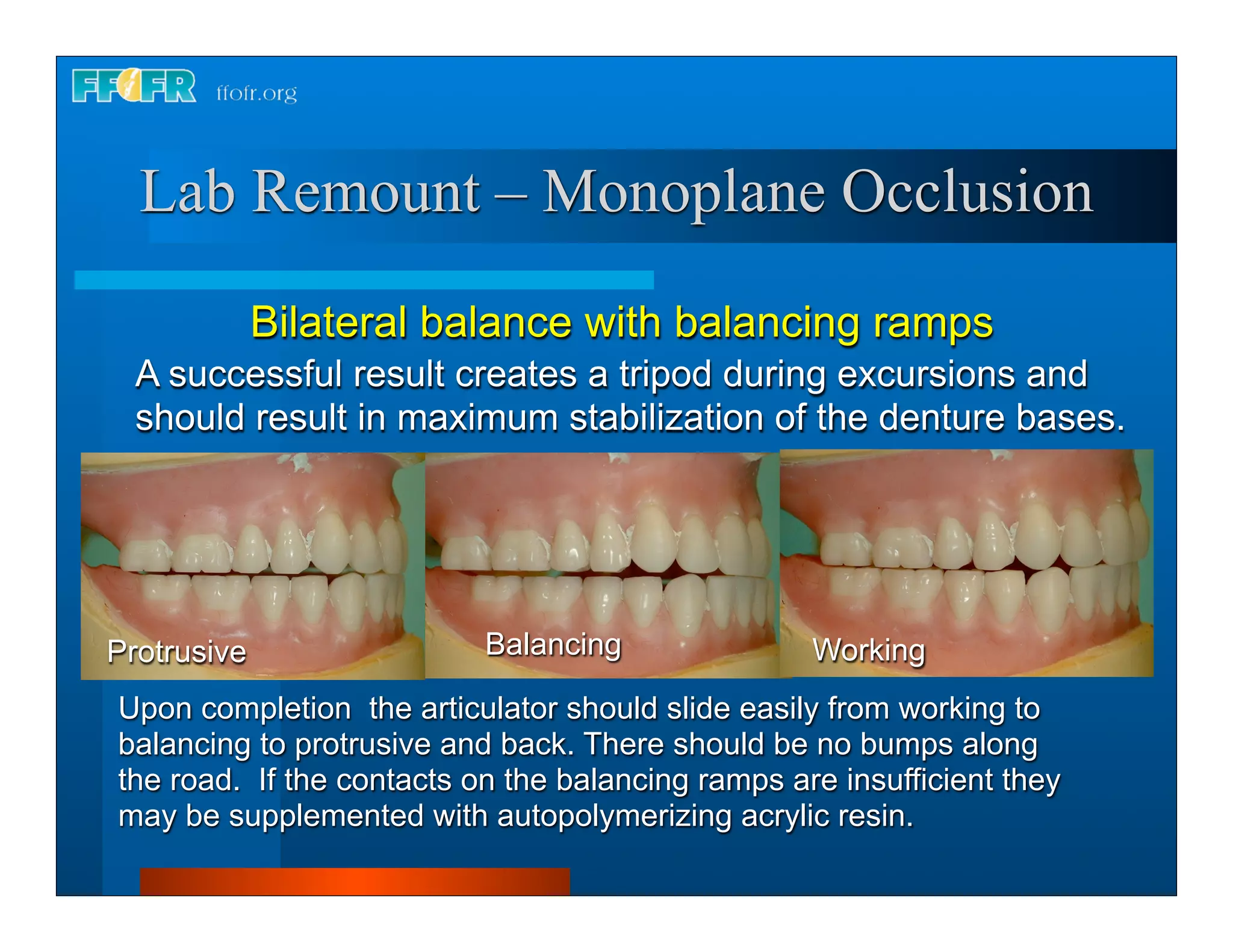 28.laboratory remount | PDF