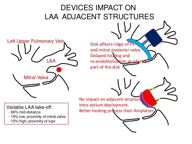 Yo prefiero el dispositivo Watchman