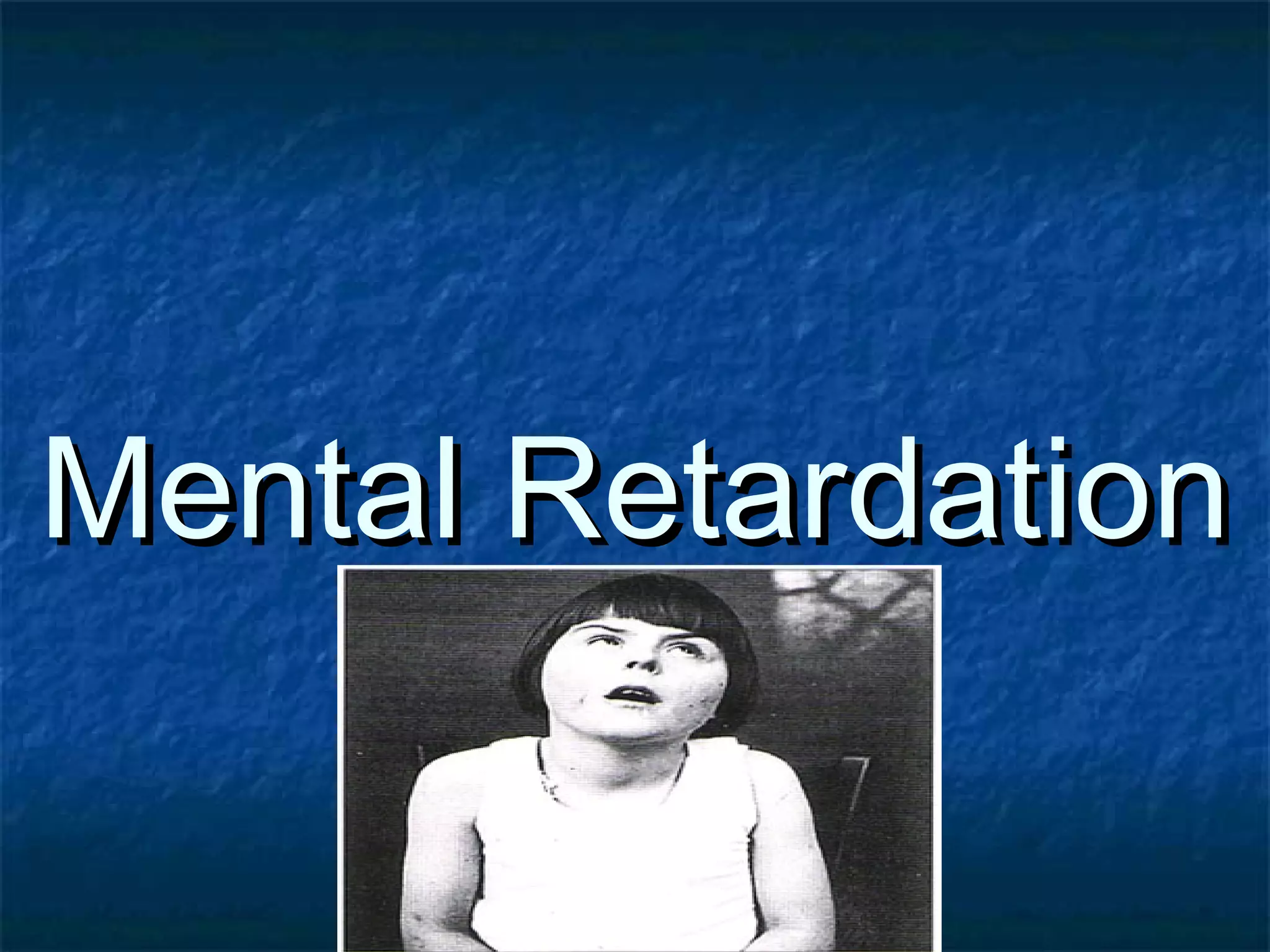mental retardation power point presentation | PPT