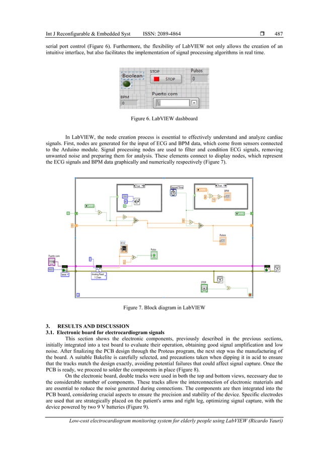 Low-cost electrocardiogram monitoring system for elderly people using LabVIEW | PDF