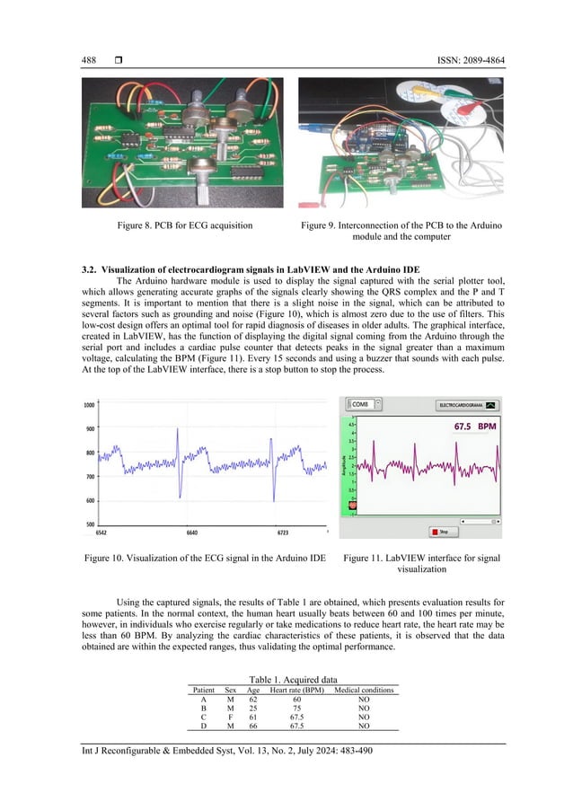 Low-cost electrocardiogram monitoring system for elderly people using LabVIEW | PDF