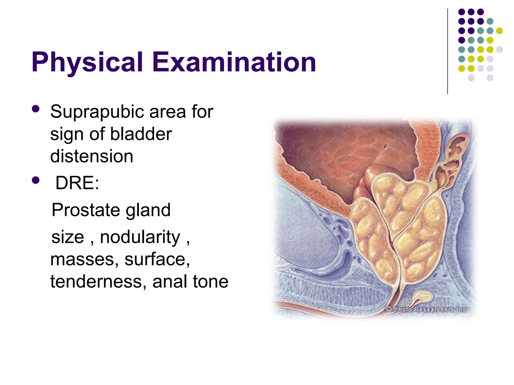 28250_Benign Prostatic Hyperplasia BPH .ppt