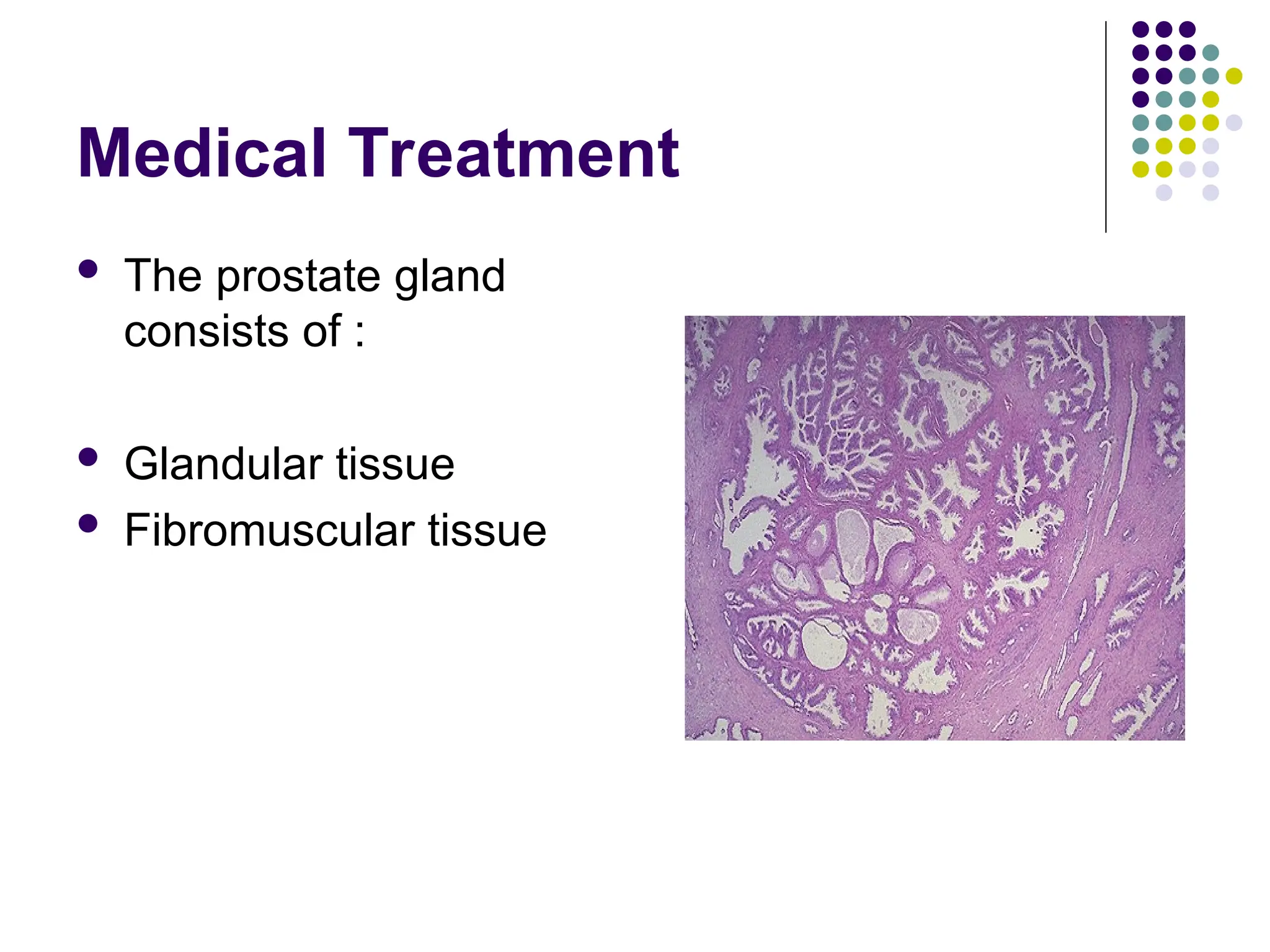 28250_Benign Prostatic Hyperplasia BPH .ppt