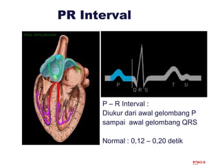 283177841-Ekg.ppt