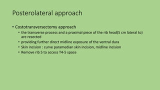 283 treatment of thoracic disk herniation | PPTX