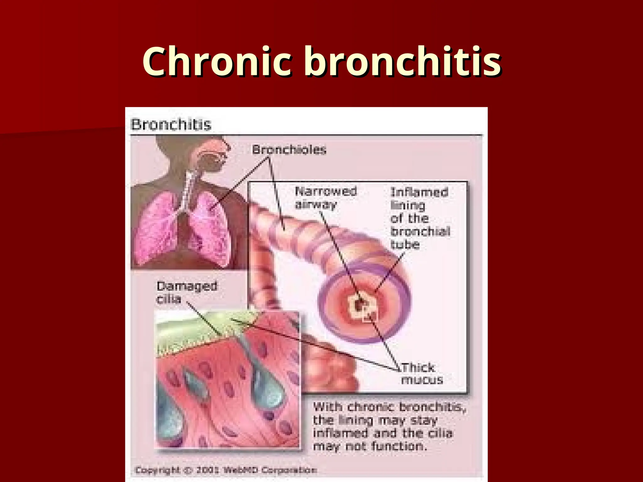 286792960-5-Bronchial-Obstruction.pptnnnnnn | PPT