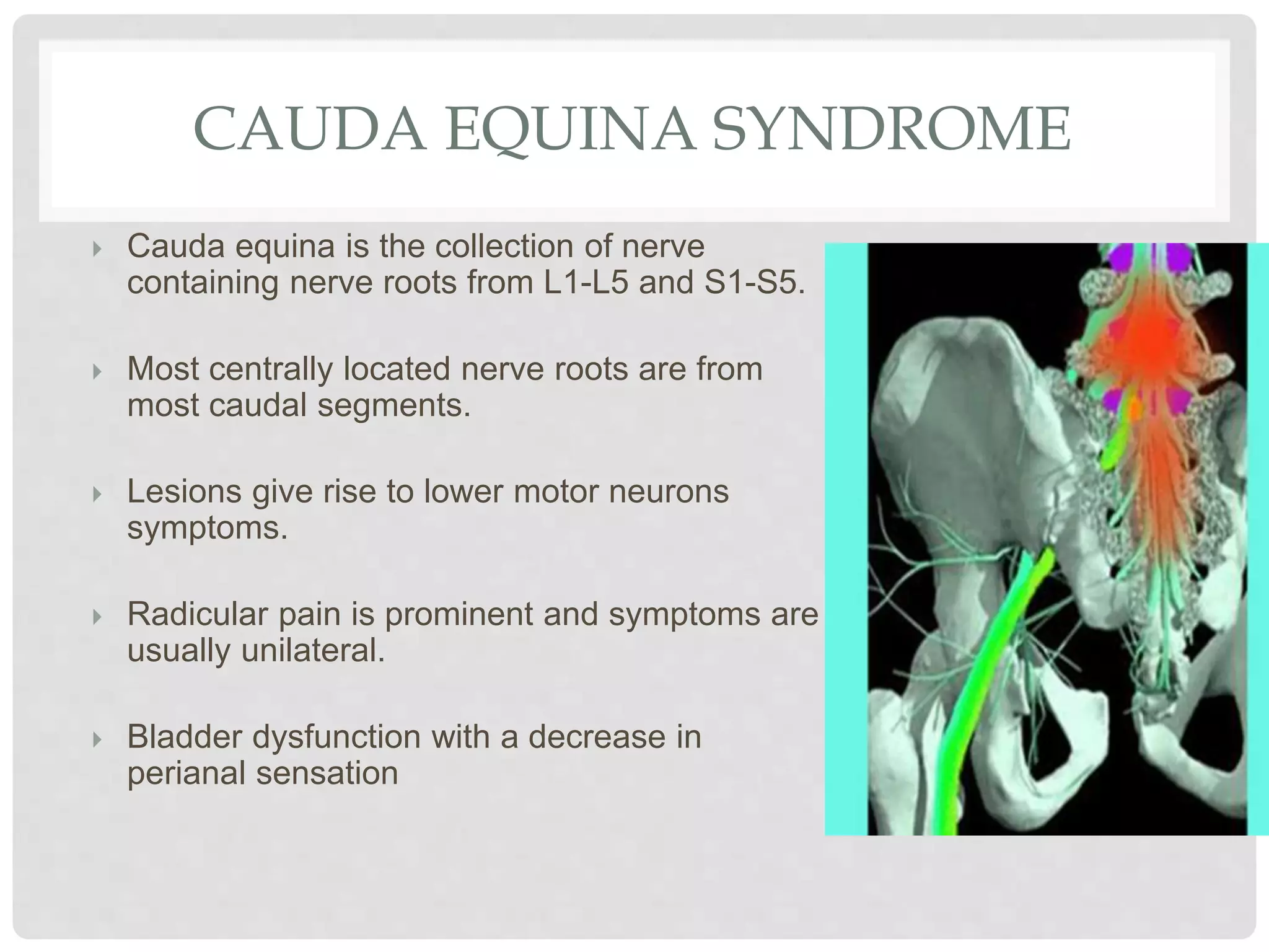 CAUDA EQUINA VS CONUS MEDULLARIS SYNDROME | PPTX
