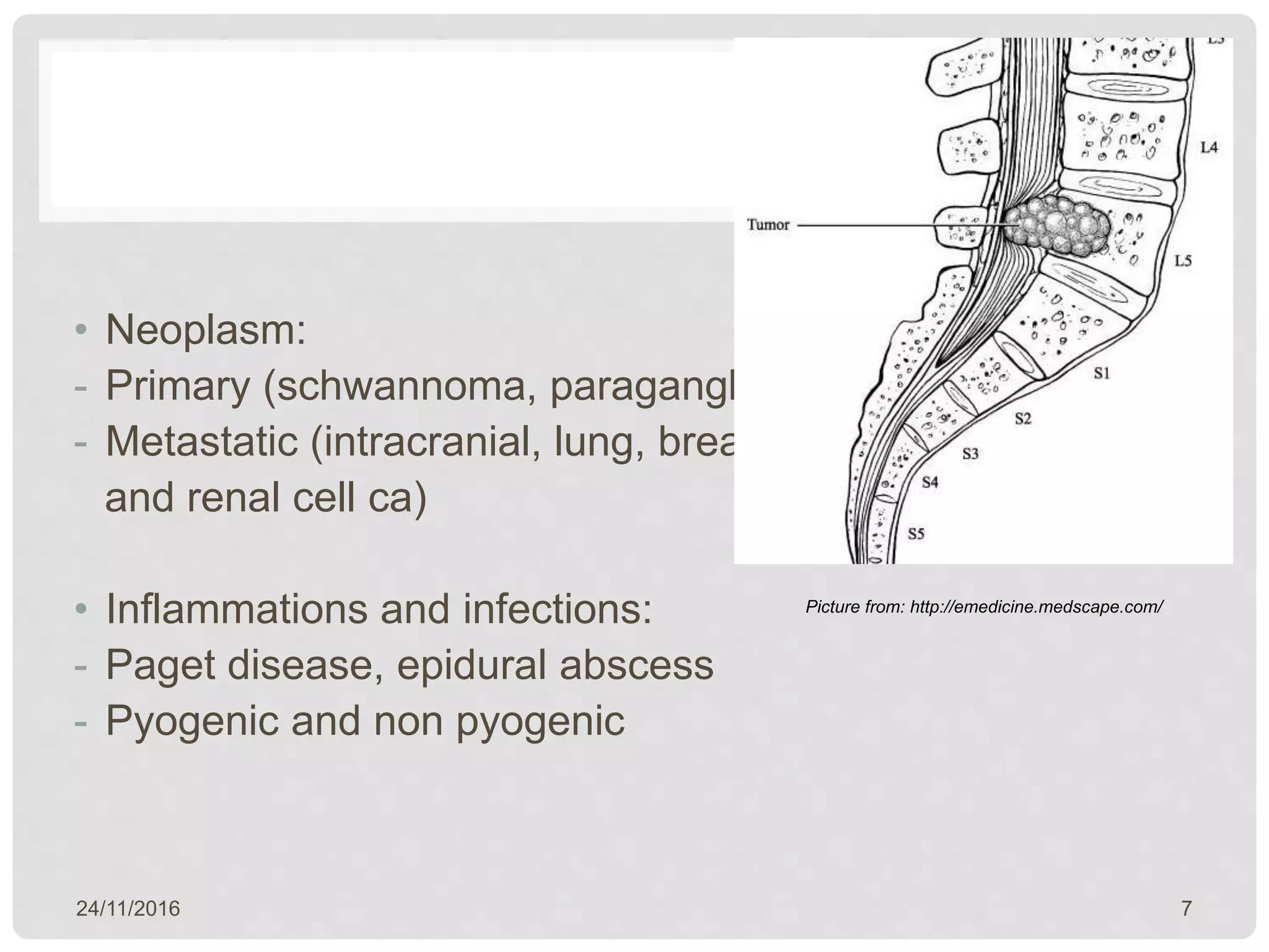 CAUDA EQUINA VS CONUS MEDULLARIS SYNDROME | PPTX