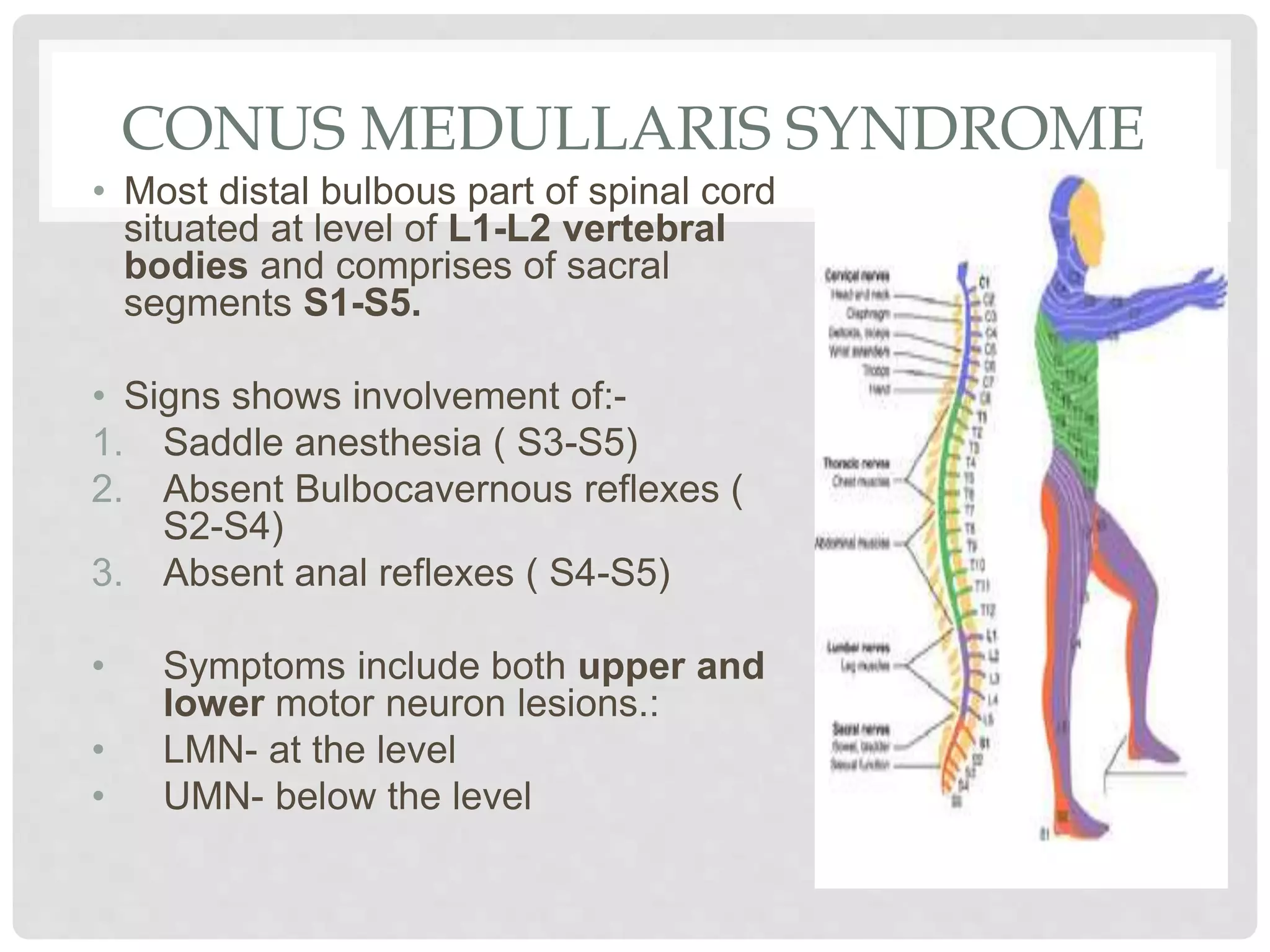 CAUDA EQUINA VS CONUS MEDULLARIS SYNDROME | PPTX | Death, Injury, or ...