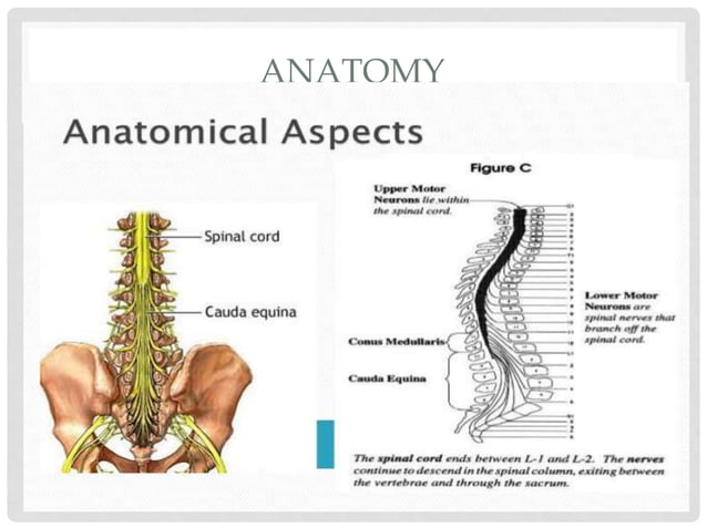 CAUDA EQUINA VS CONUS MEDULLARIS SYNDROME | PPTX | Death, Injury, or ...