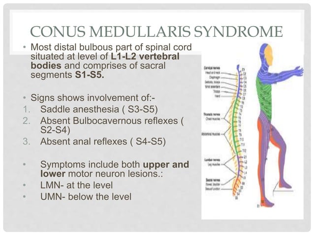 CAUDA EQUINA VS CONUS MEDULLARIS SYNDROME | PPTX | Death, Injury, or ...