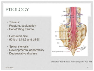 Conus Medullaris Syndrome Vs Cauda Equina Syndrome