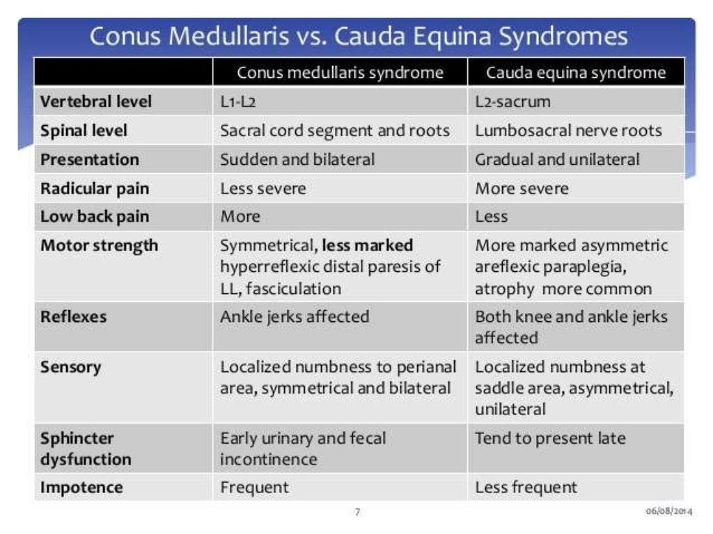 CAUDA EQUINA VS CONUS MEDULLARIS SYNDROME