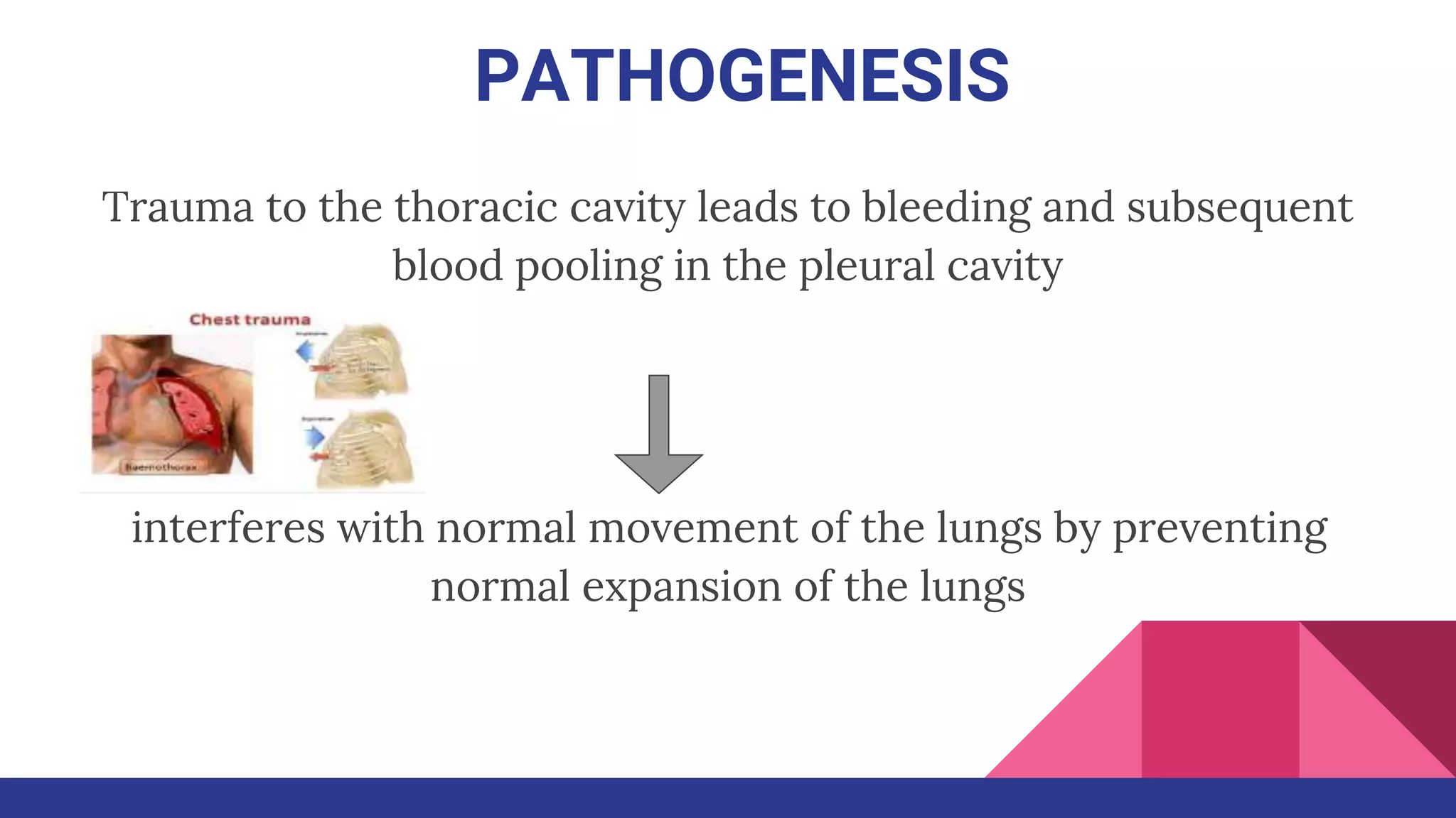 massive hemothorax | PPTX