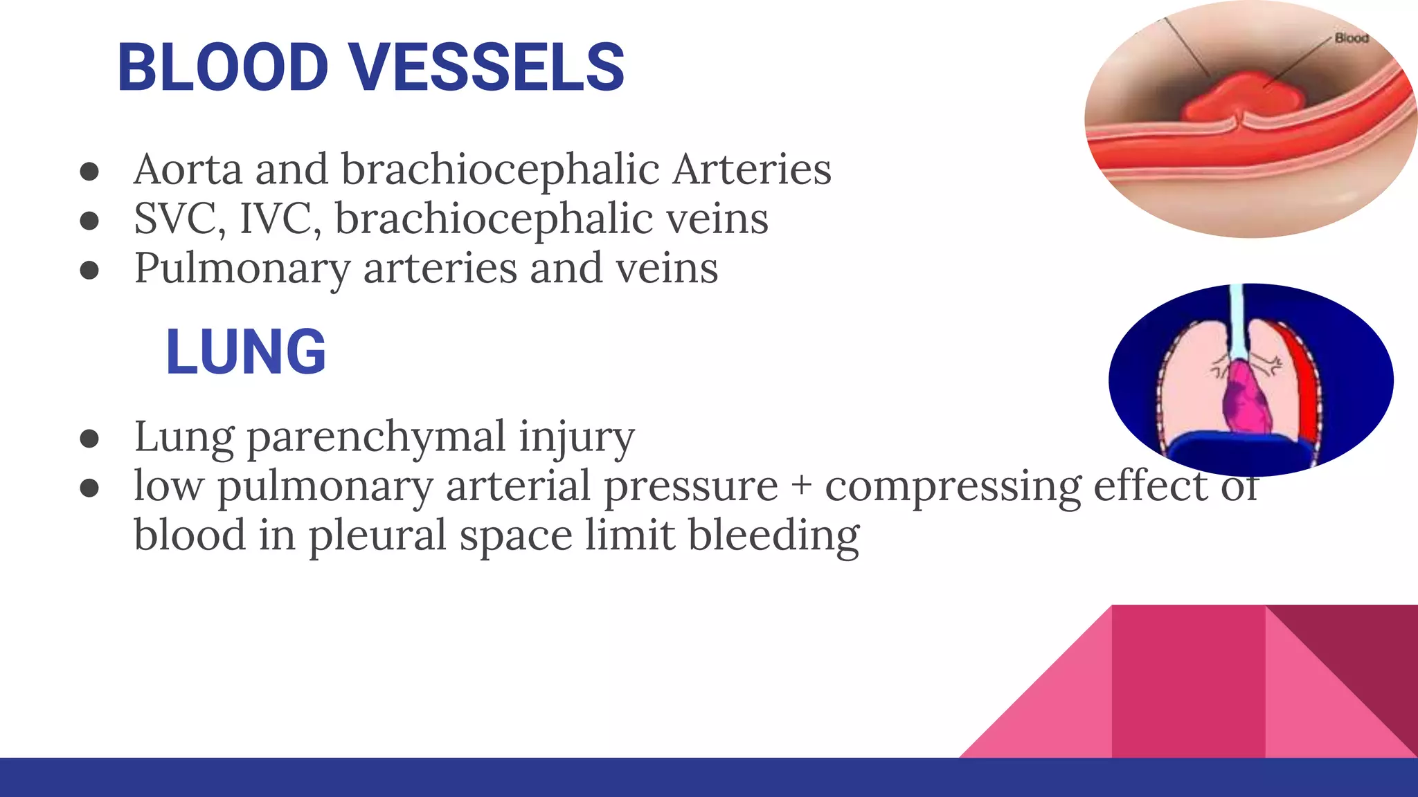 massive hemothorax | PPTX