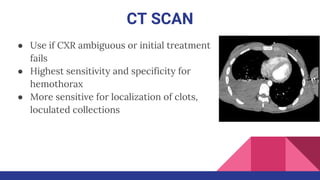 massive hemothorax | PPTX