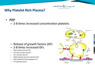 Johannes Tol - hamstring injuries- PRP | PPT