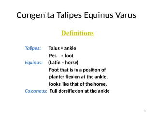 Clubfoot and stage wise management of children.pptx