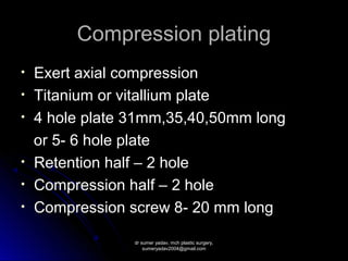 mandibular fractures | PPT