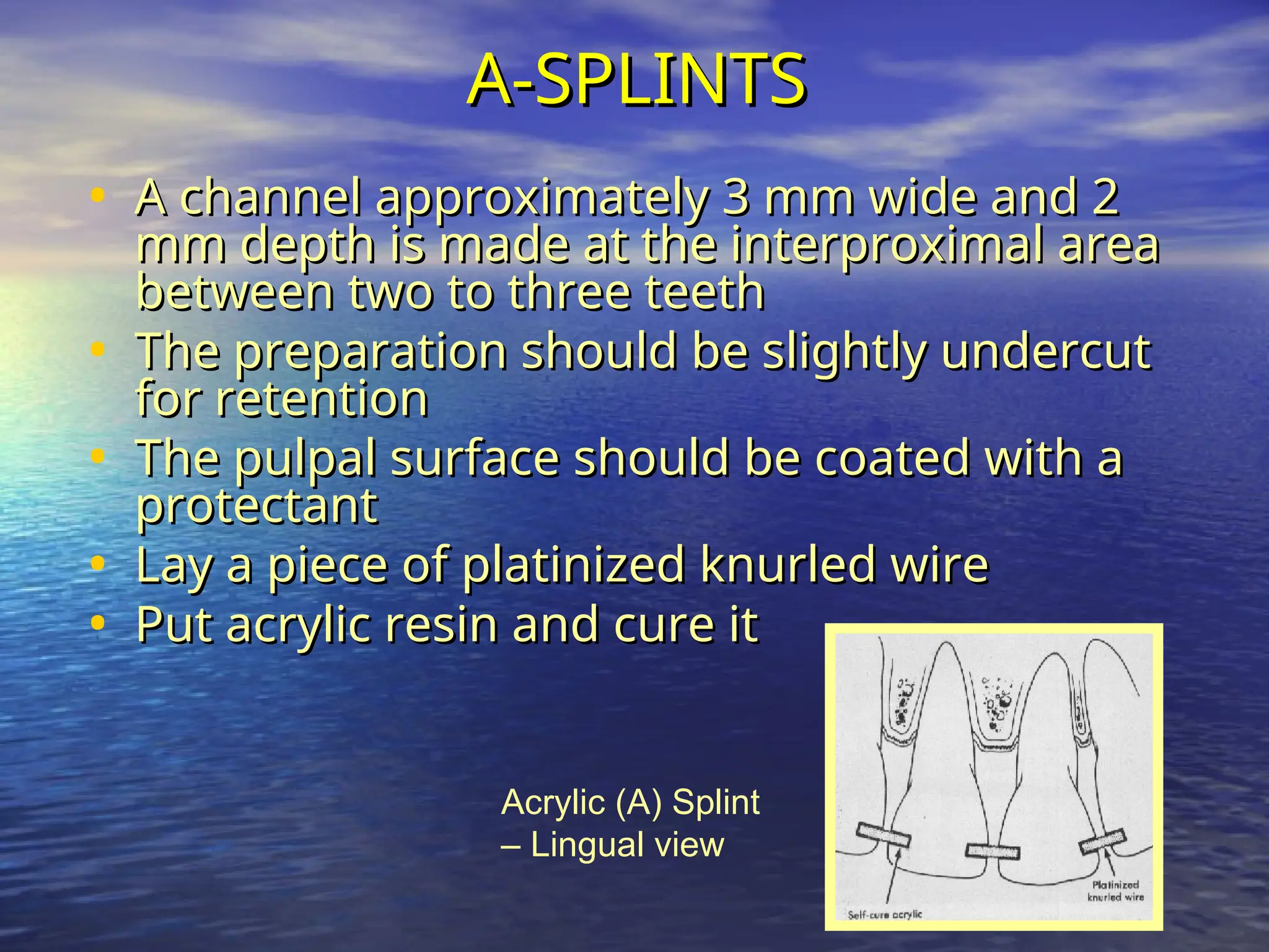 28 PERIODONTAL SPLINTS A boon in disguise . | PPT