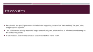 28 Periodontitis new.,best ppt for understanding and notes | PPTX