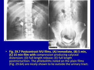29 DAVID SUTTON PICTURES THE UROGENITAL TRACT ANATOMY AND INVESTIGATION ...