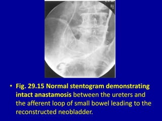 29 DAVID SUTTON PICTURES THE UROGENITAL TRACT ANATOMY AND INVESTIGA…