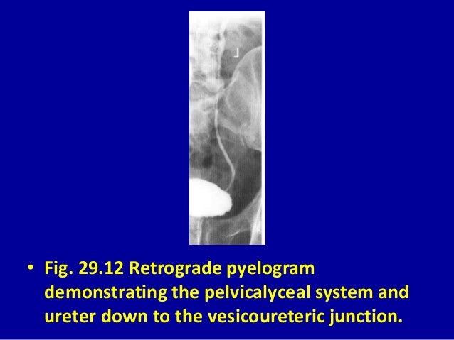 29 DAVID SUTTON PICTURES THE UROGENITAL TRACT ANATOMY AND INVESTIGA…