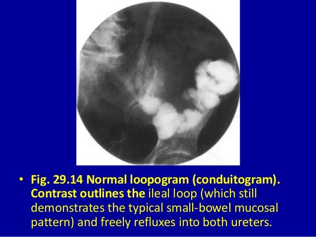 29 DAVID SUTTON PICTURES THE UROGENITAL TRACT ANATOMY AND INVESTIGA…