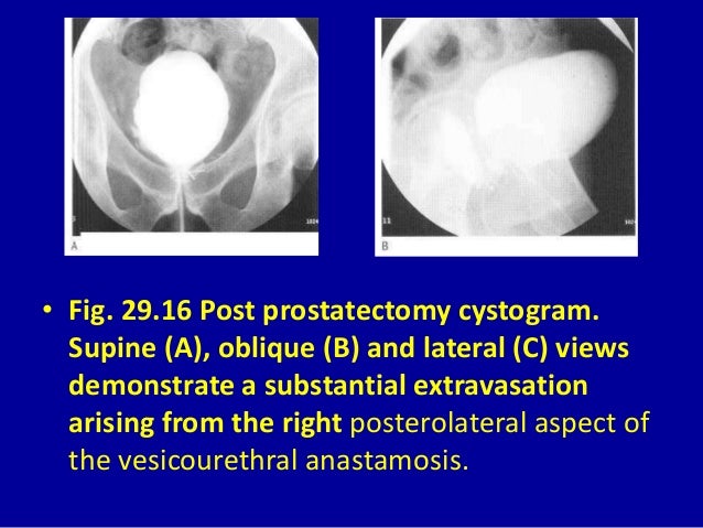 29 DAVID SUTTON PICTURES THE UROGENITAL TRACT ANATOMY AND INVESTIGA…
