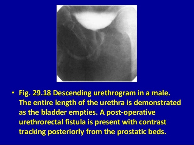 29 DAVID SUTTON PICTURES THE UROGENITAL TRACT ANATOMY AND INVESTIGA…