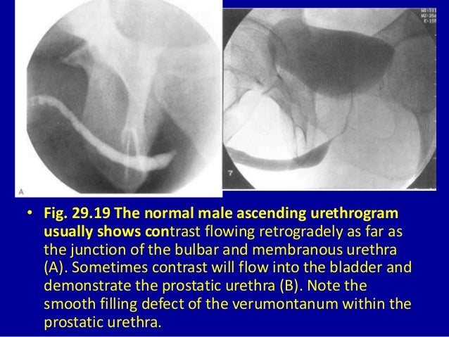 29 DAVID SUTTON PICTURES THE UROGENITAL TRACT ANATOMY AND INVESTIGA…