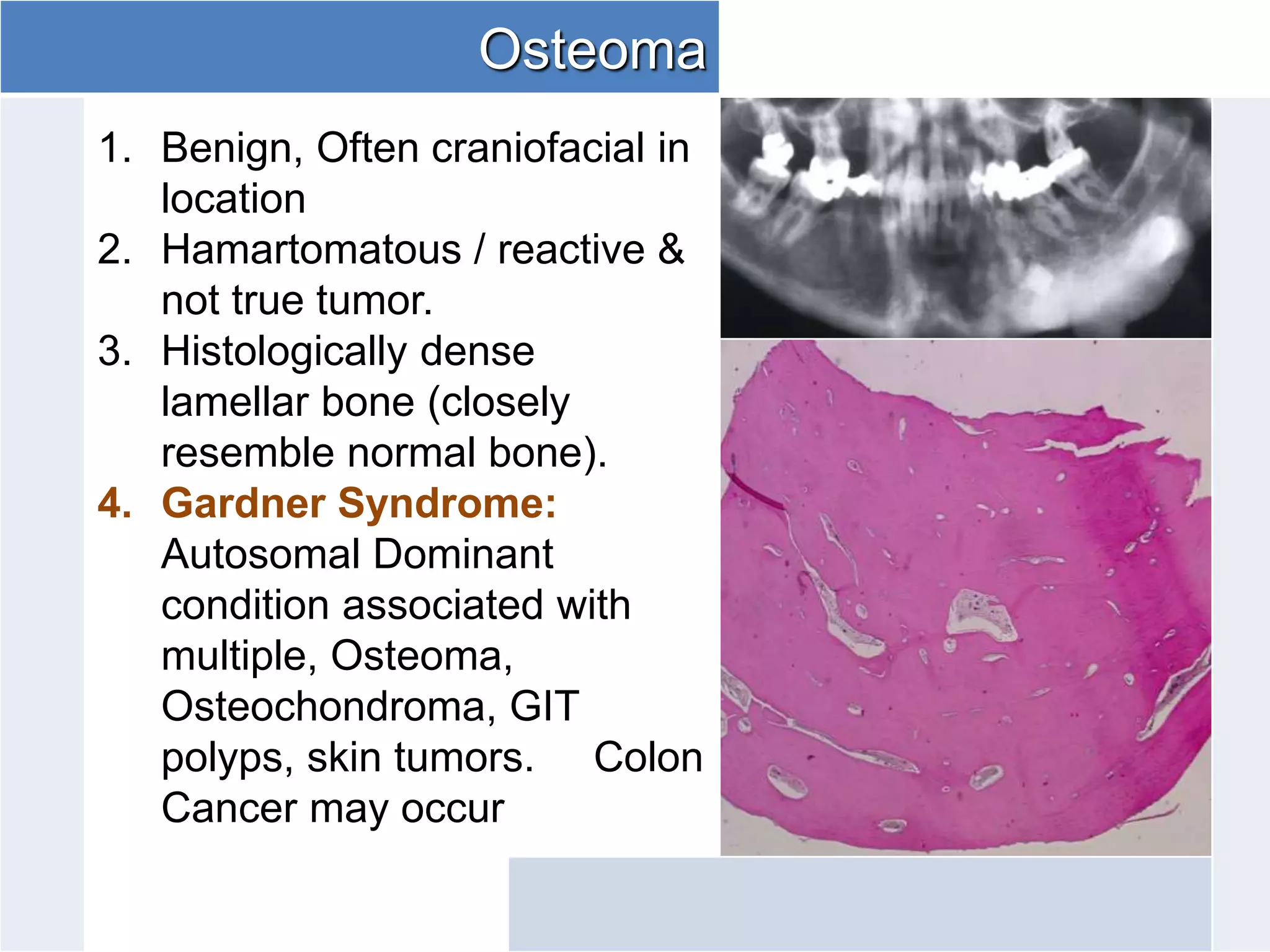 Tumors of bone | PPTX